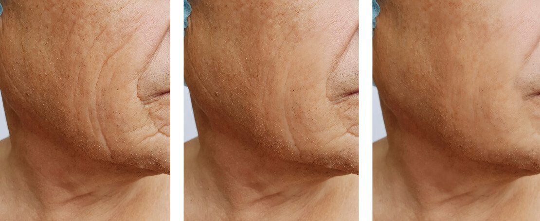 Vichen คืออะไรอะไรผลิตภัณฑ์ครีมแท้ราคารีวิวของซื้อที่ไหนวิธีนวดเทศไทย ...